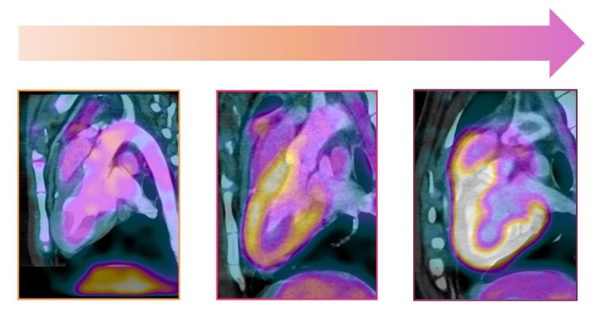 cardiotoxicidad – En Segundos Panama